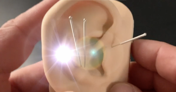 The Ear as an Access Point for Neuro-functional Methods – Canadian ...