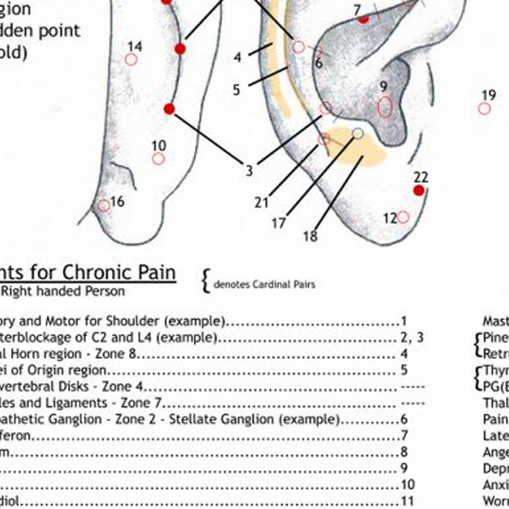 Ear Wall Chart of Chronic Pain Points – Canadian Institute of Auricular ...