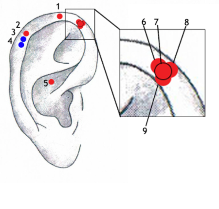 Ear Wall Chart of Indicator Points for Trace Elements and Vitamins ...